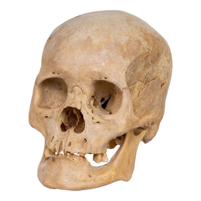 Real Human Skull - Genuine Human Skulls